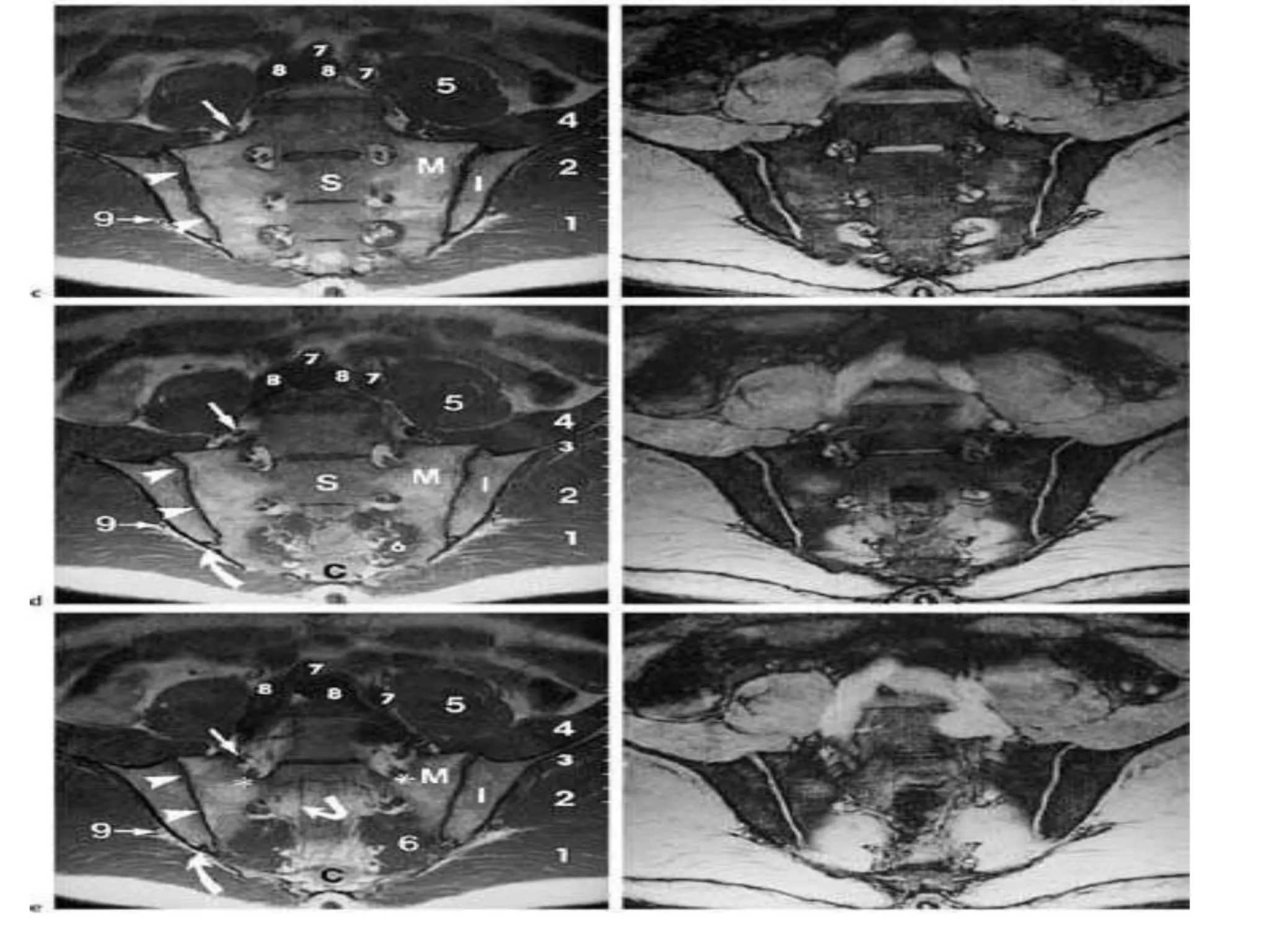SI JOINT PATHOLOGIES.pptx