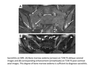 SI JOINT PATHOLOGIES.pptx