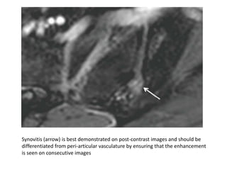 SI JOINT PATHOLOGIES.pptx