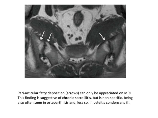 SI JOINT PATHOLOGIES.pptx