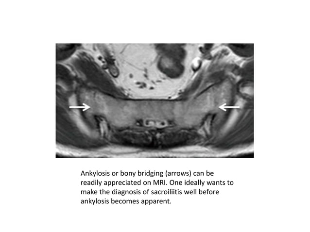 SI JOINT PATHOLOGIES.pptx