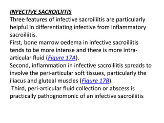 SI JOINT PATHOLOGIES.pptx
