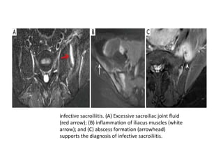 SI JOINT PATHOLOGIES.pptx