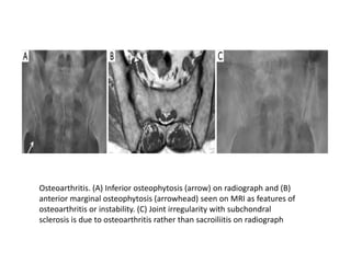 SI JOINT PATHOLOGIES.pptx