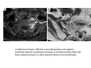SI JOINT PATHOLOGIES.pptx