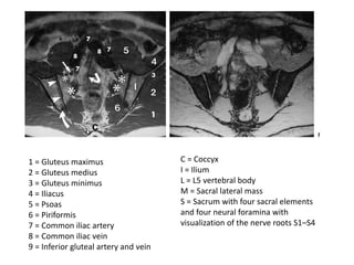 SI JOINT PATHOLOGIES.pptx