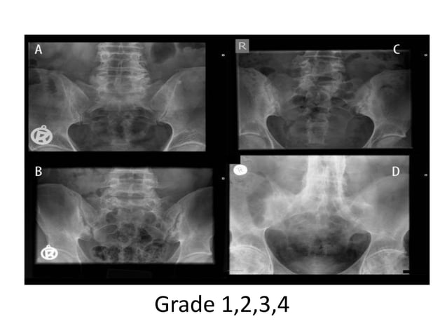 SI JOINT PATHOLOGIES.pptx