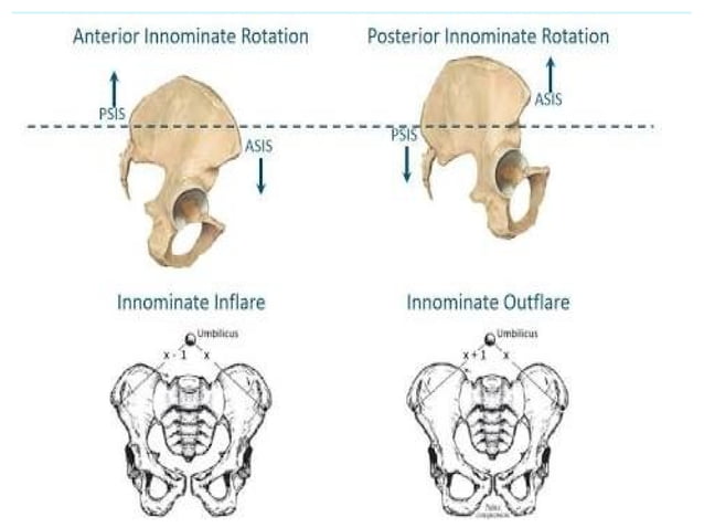 SI (Sacroiliac) Joint & Pelvic Complex Biomechanics | PPTX