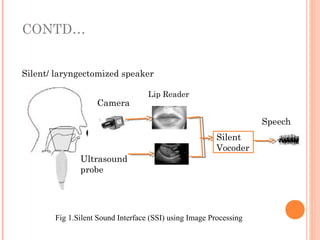 Silent sound-technology ppt final | PPT