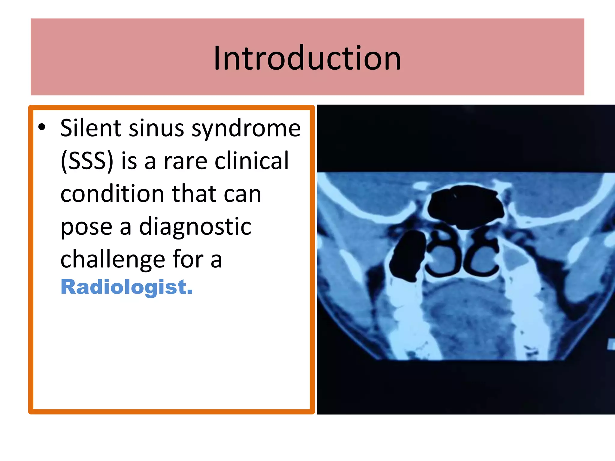 Silent sinus syndrome-In the eye of a Radiologist | PPTX