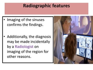 Silent sinus syndrome-In the eye of a Radiologist | PPTX