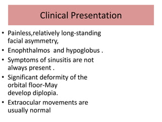Silent sinus syndrome-In the eye of a Radiologist | PPTX