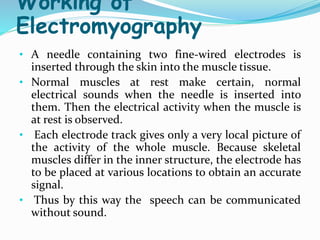 Silent sound technologyrevathippt | PPT