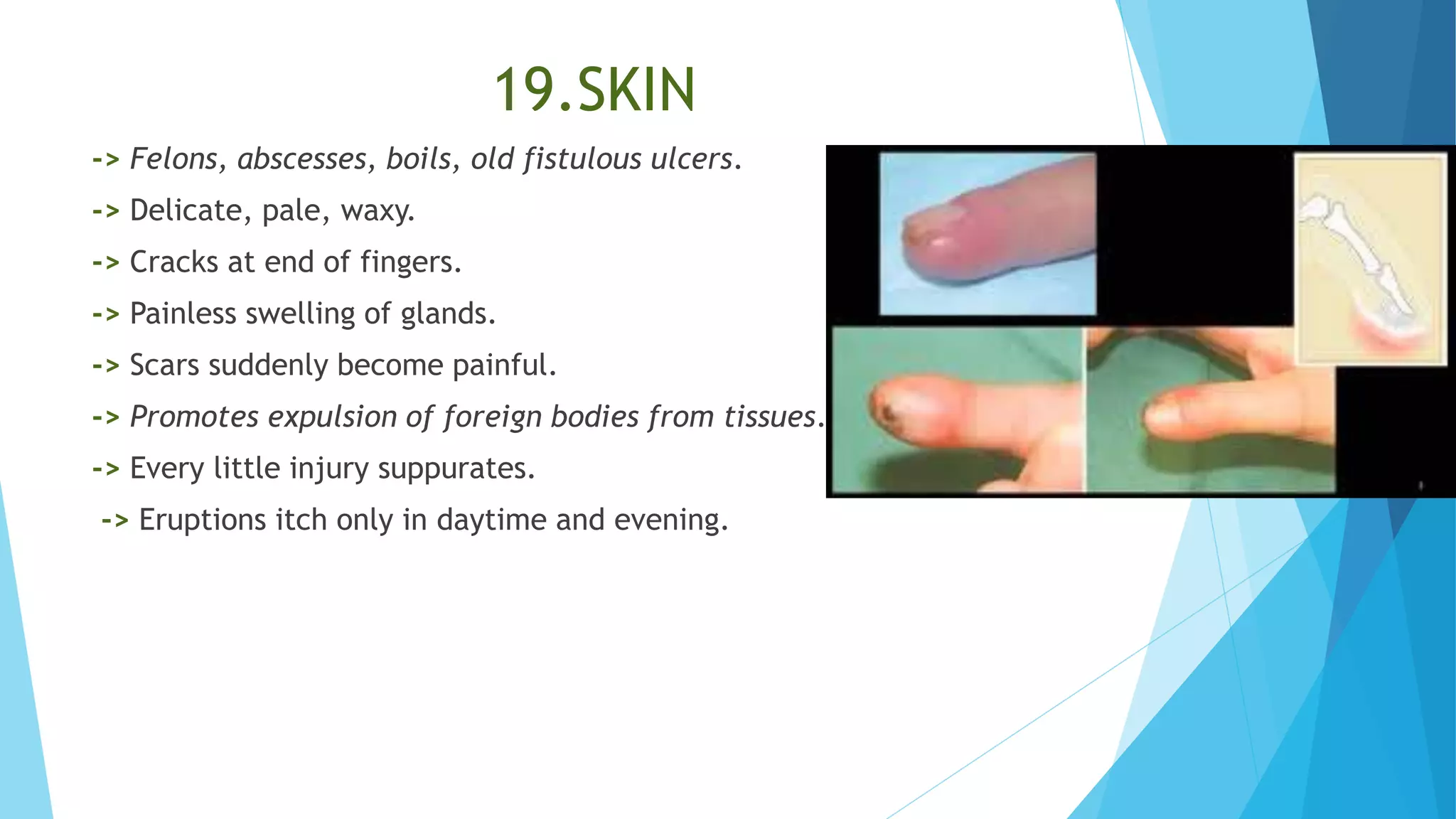 Silicea terra | PPTX