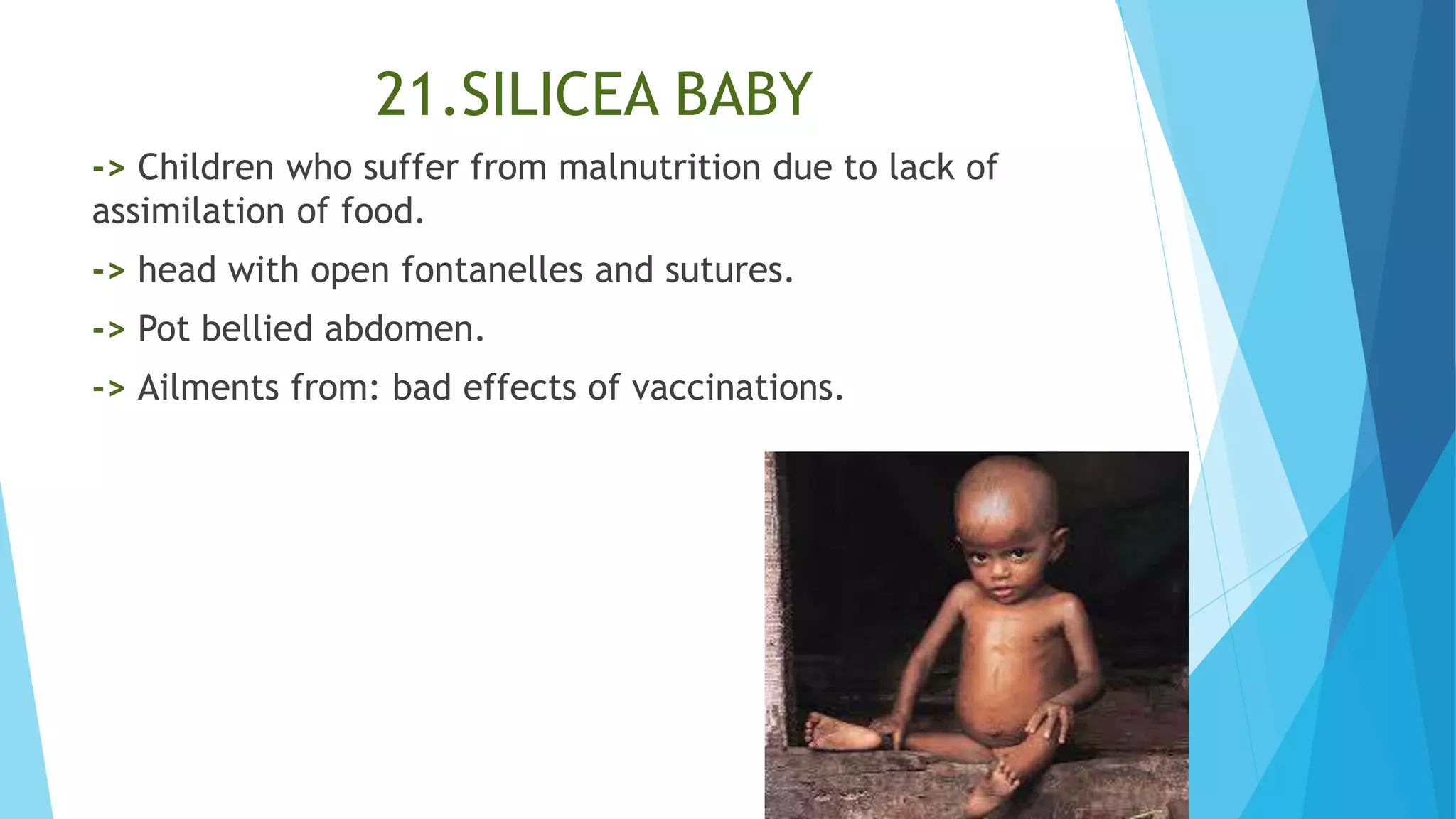 Silicea terra | PPTX