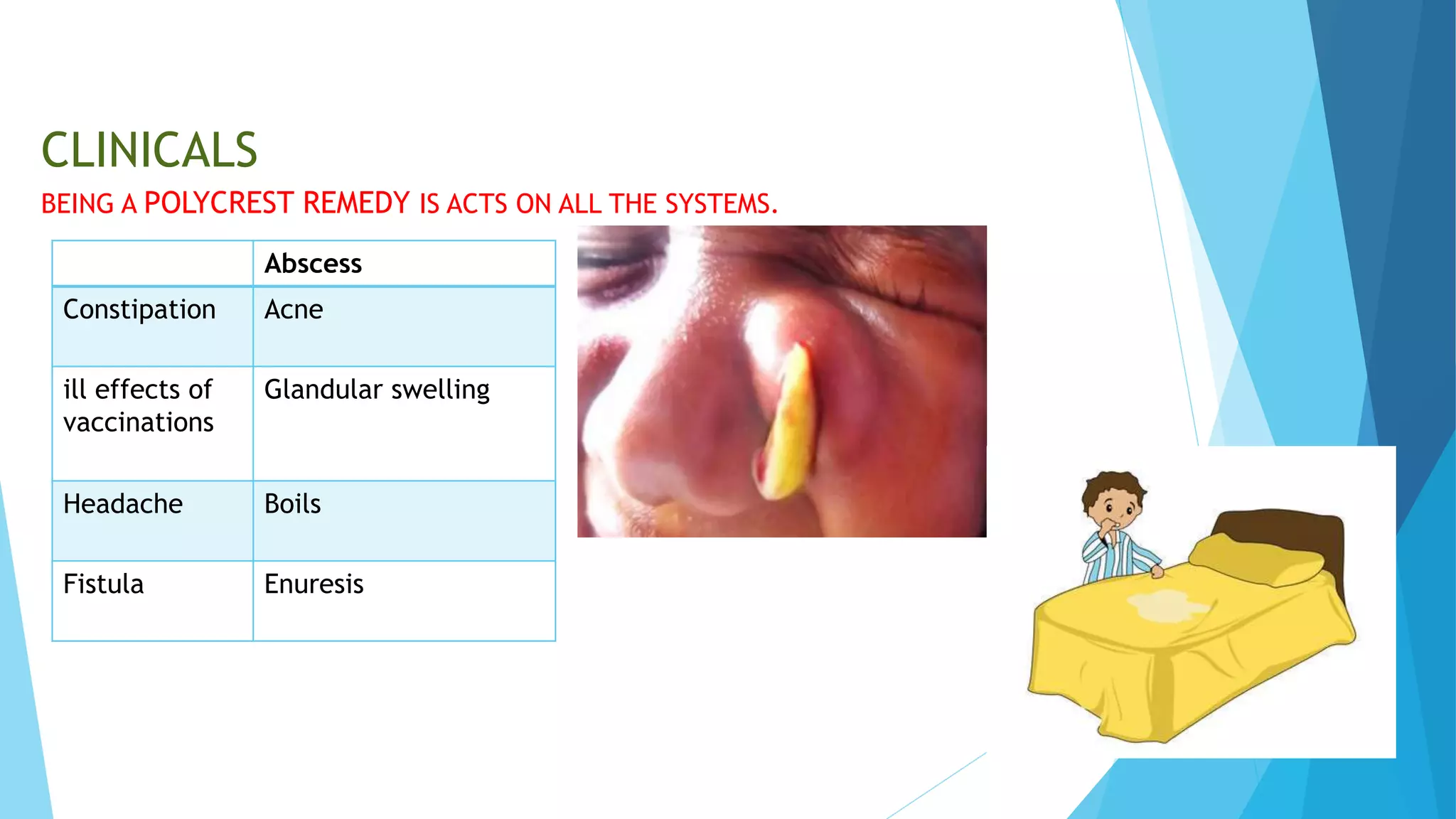 Silicea terra | PPTX