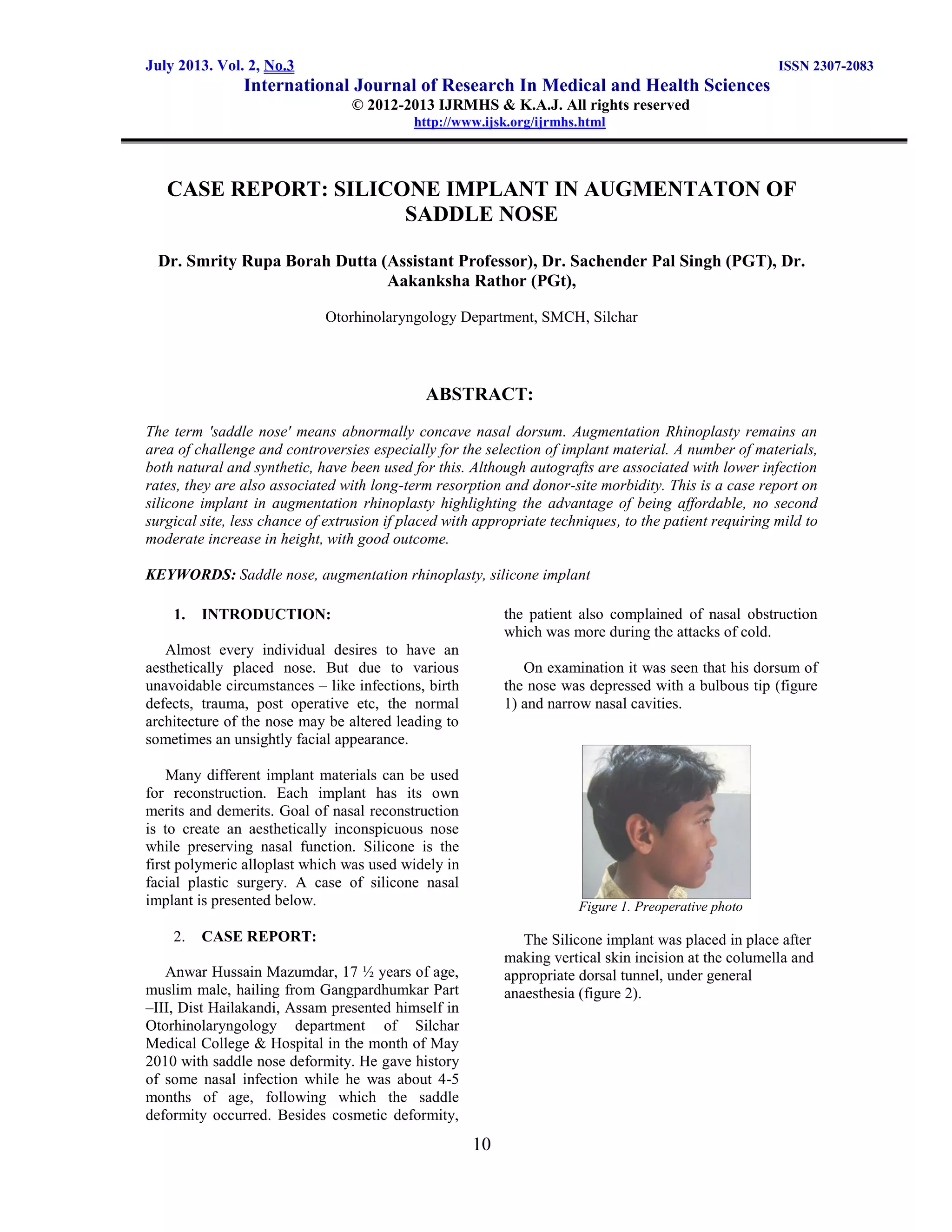 Silicone implant | PDF