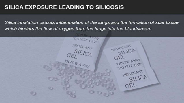 SILICOSIS.pptx [medical surgical Nursing] | PPTX