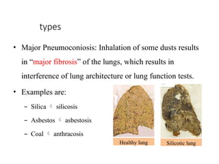 Occupational lung disease - Silicosis.pptx
