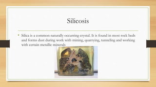 Silicosis in miners hidalgo | PPSX