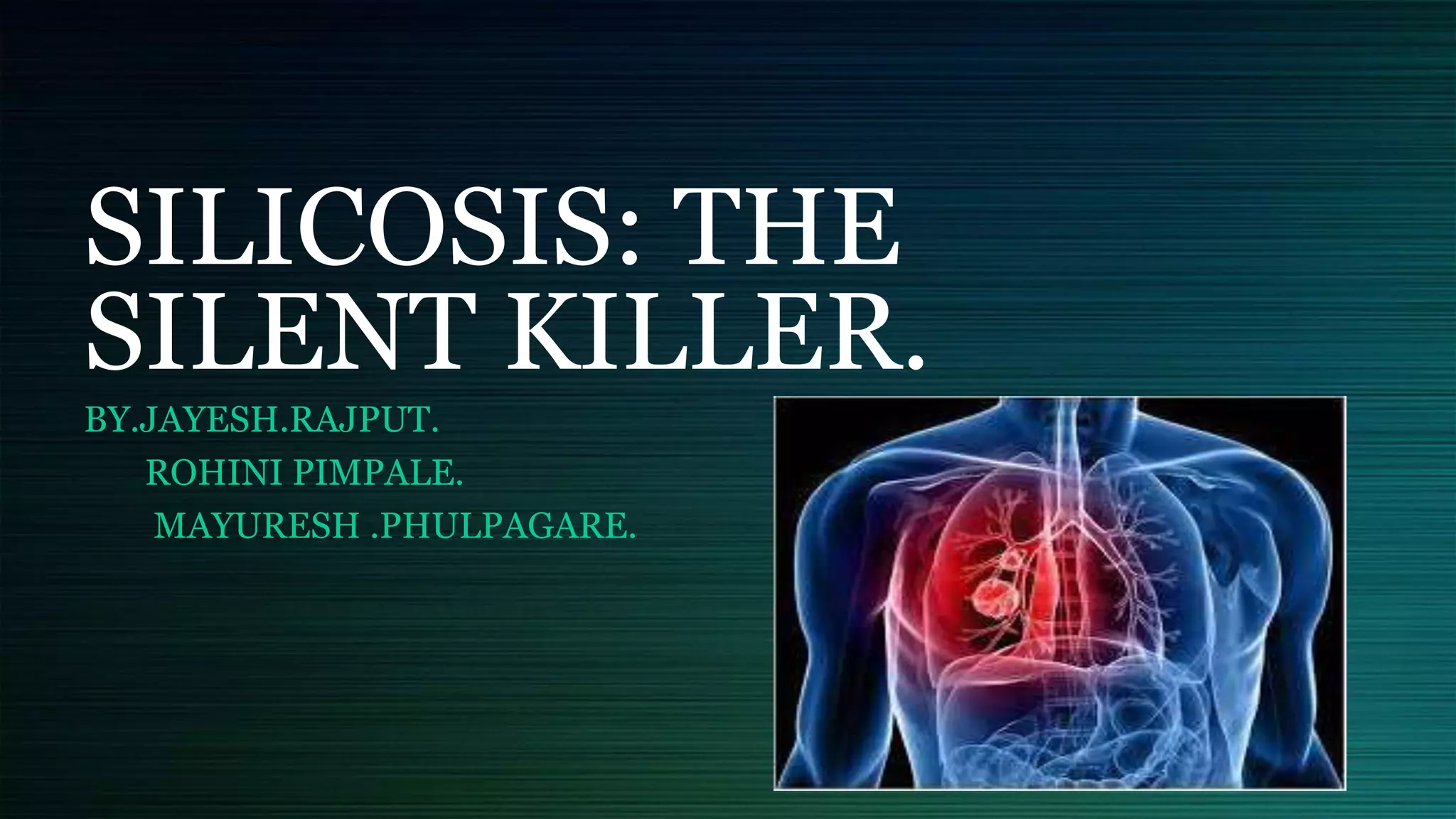 Silicosis disease | PPTX
