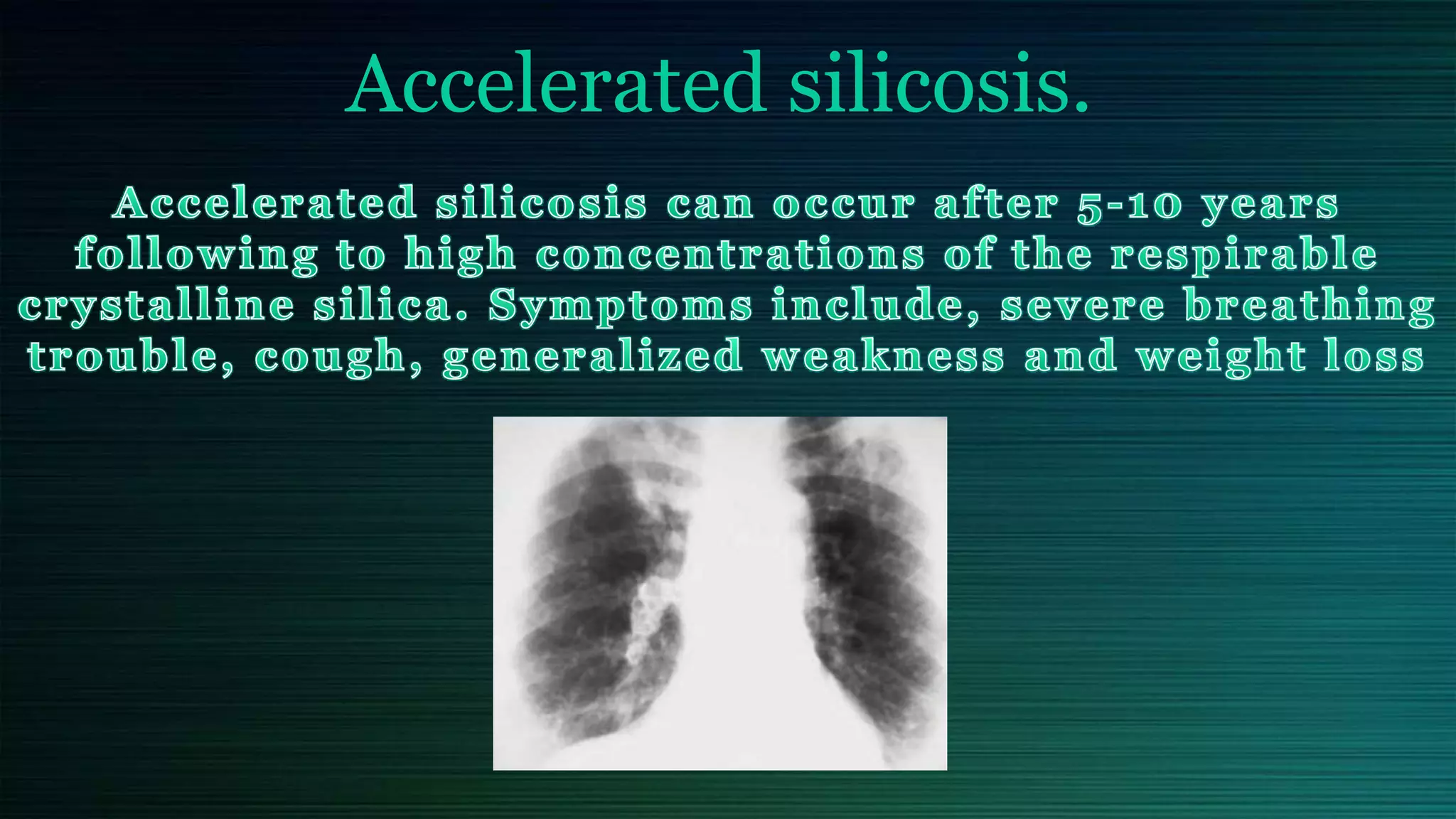 Silicosis disease | PPTX