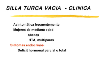 Silla turca vacia | PPT