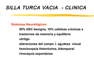 Silla turca vacia | PPT