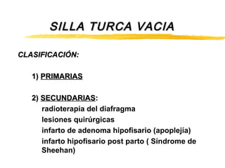 Silla turca vacia | PPT