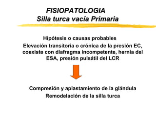 Silla turca vacia | PPT