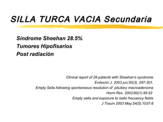 Silla turca vacia | PPT