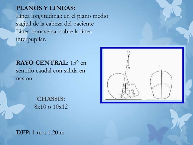 Silla turca | PPTX