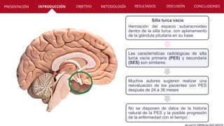 Síndrome de la silla turca: diagnóstico y manejo | PPTX