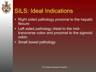 Sils | PPT