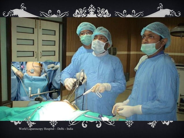 Single incision laparoscopic Surgery-SILS | PPT