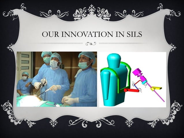 Single incision laparoscopic Surgery-SILS | PPT