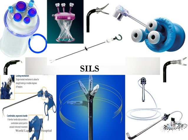 Single incision laparoscopic Surgery-SILS | PPT