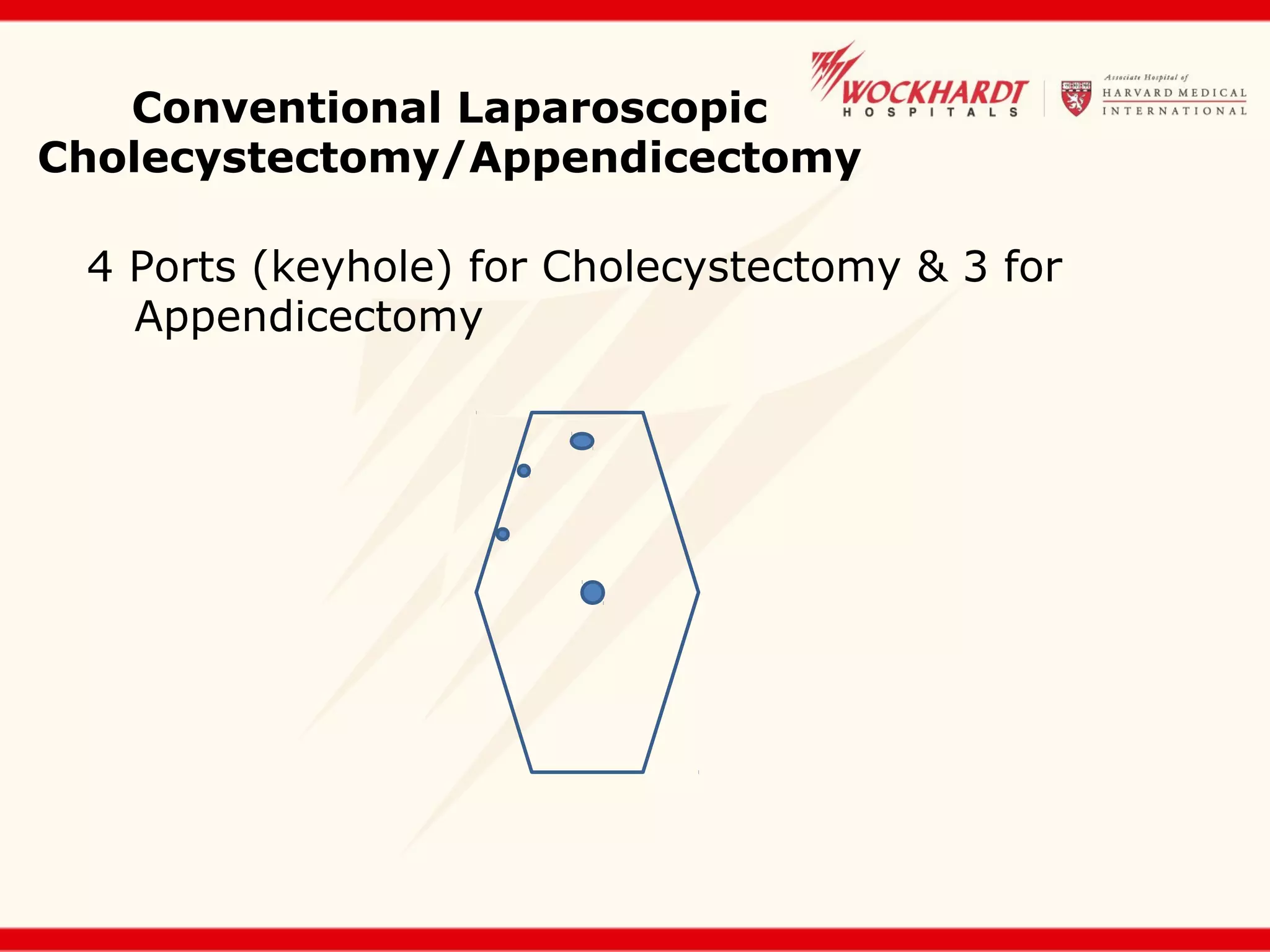 Single Incision Laparoscopic Surgery | PPT