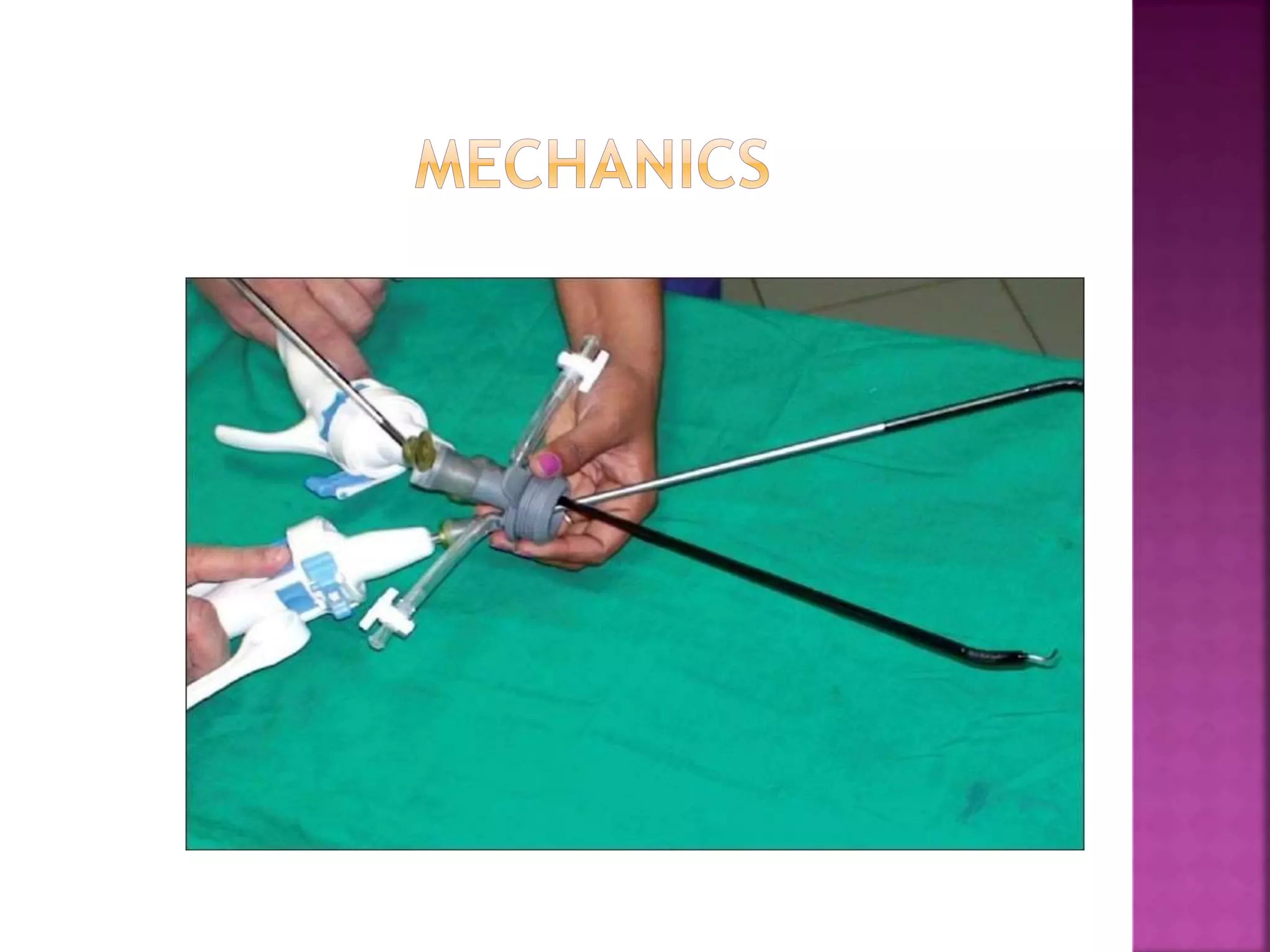 SILS - SINGLE INCISION LAPAROSCOPIC SURGERY | PPTX