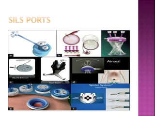 SILS - SINGLE INCISION LAPAROSCOPIC SURGERY | PPTX