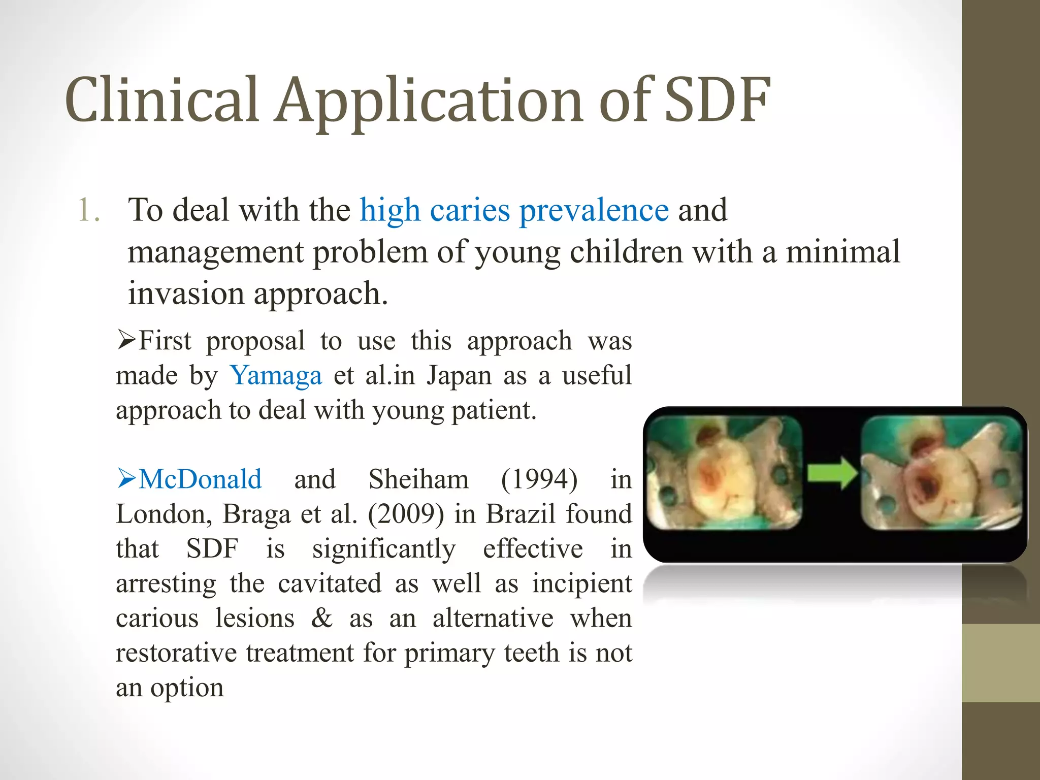 Silver diamine flouride | PPTX