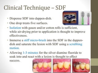 Silver diamine flouride | PPTX