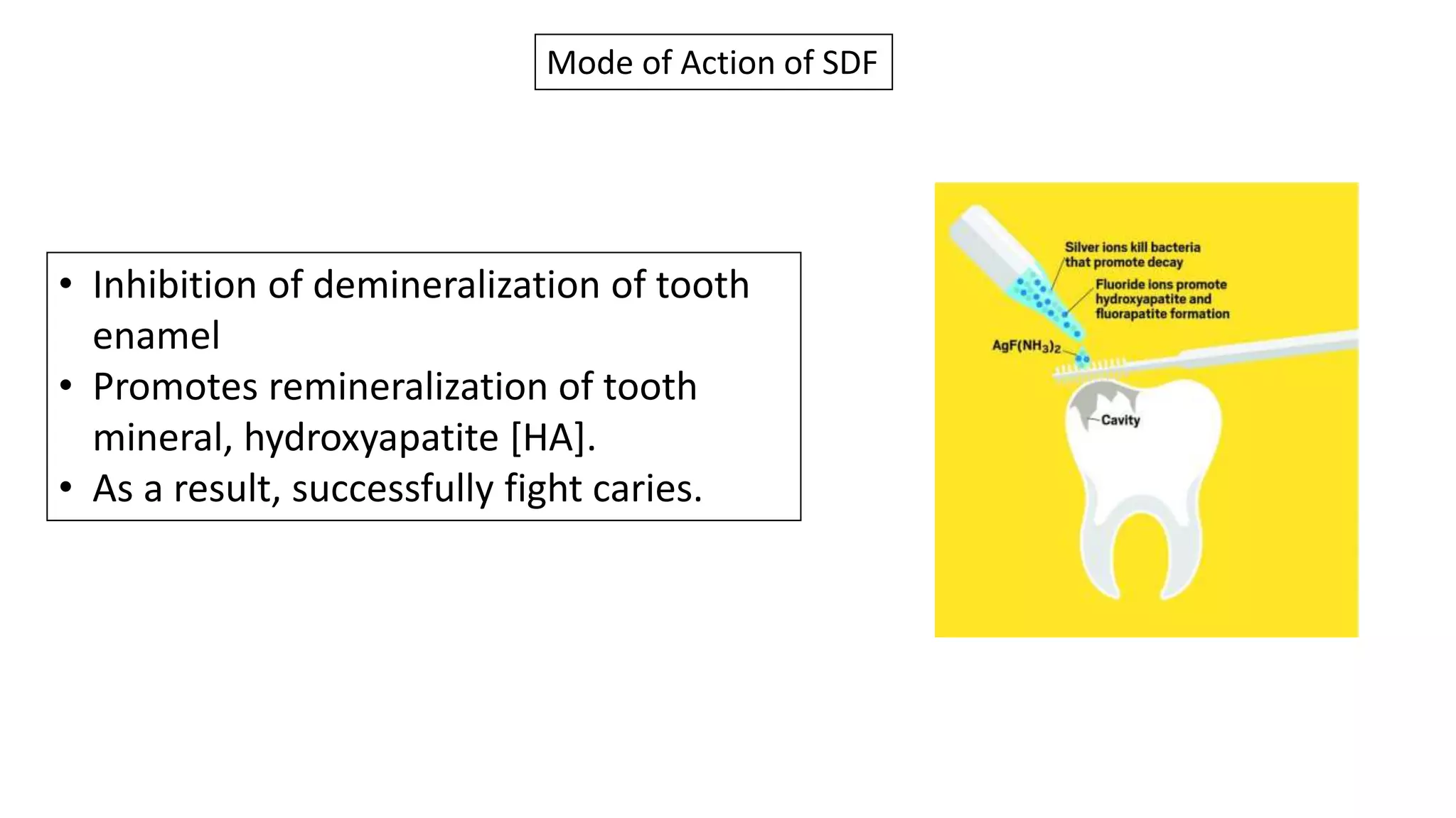 Silver Diamine Flouride [SDF].pptx
