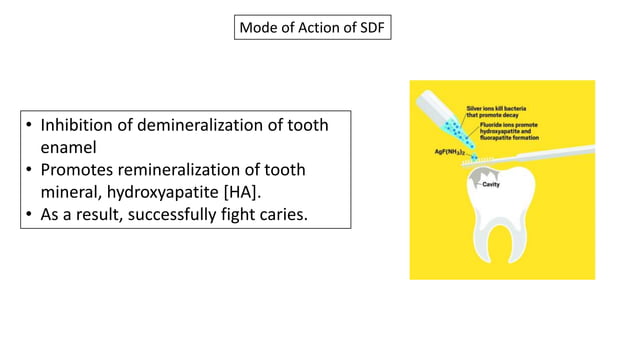 Silver Diamine Flouride [SDF].pptx | Oral care | Personal Care