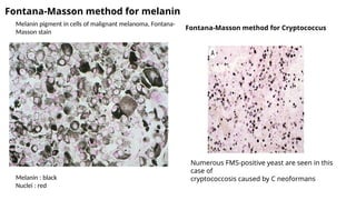 SILVER STAINING METHODS, CLASSIFICATIONS OF SILVER STAINS | PPTX