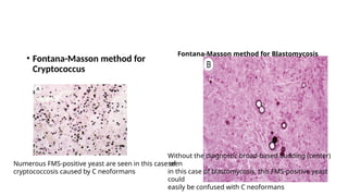SILVER STAINING METHODS, CLASSIFICATIONS OF SILVER STAINS | PPTX