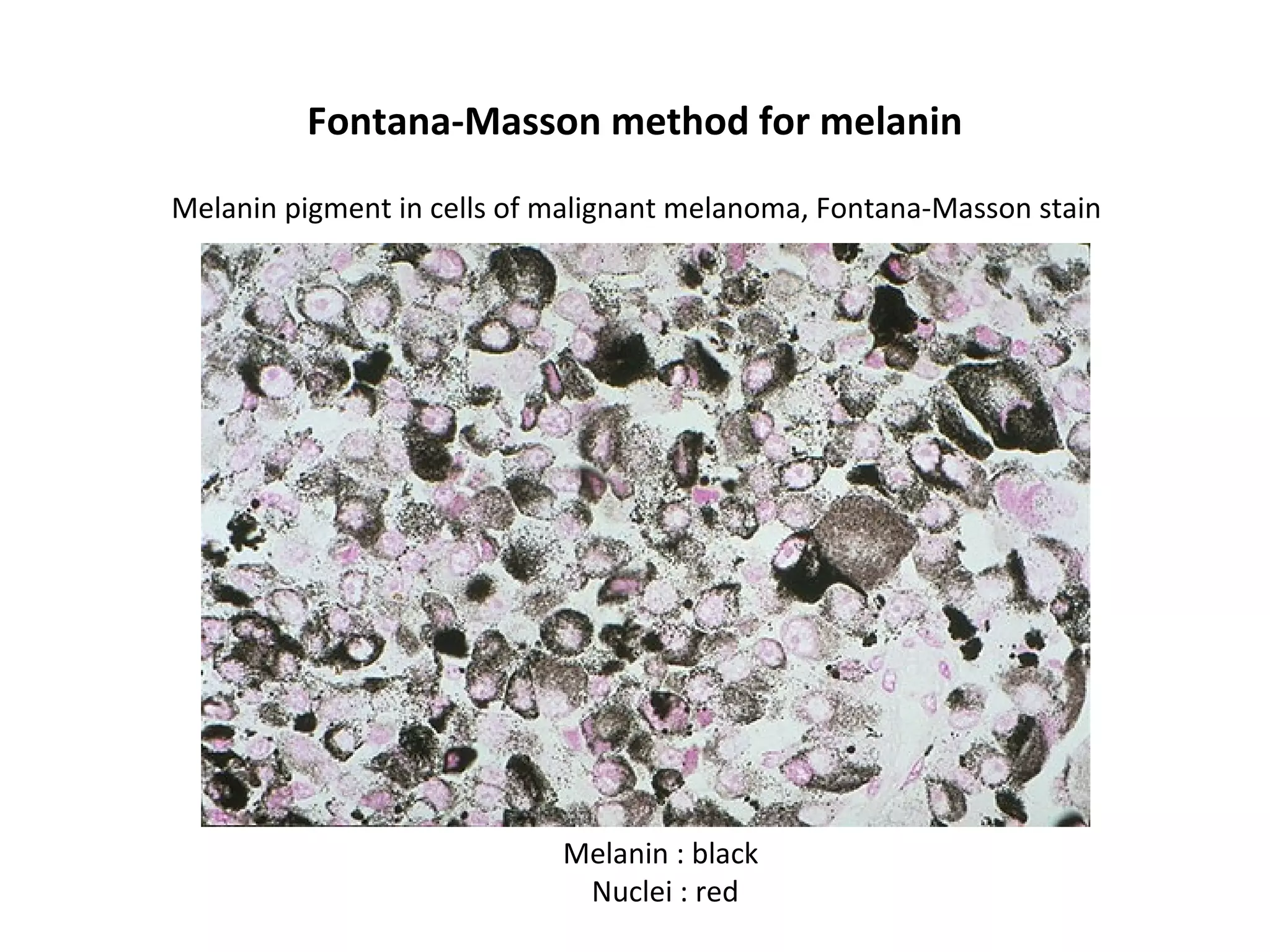 Silver Staining | PPT