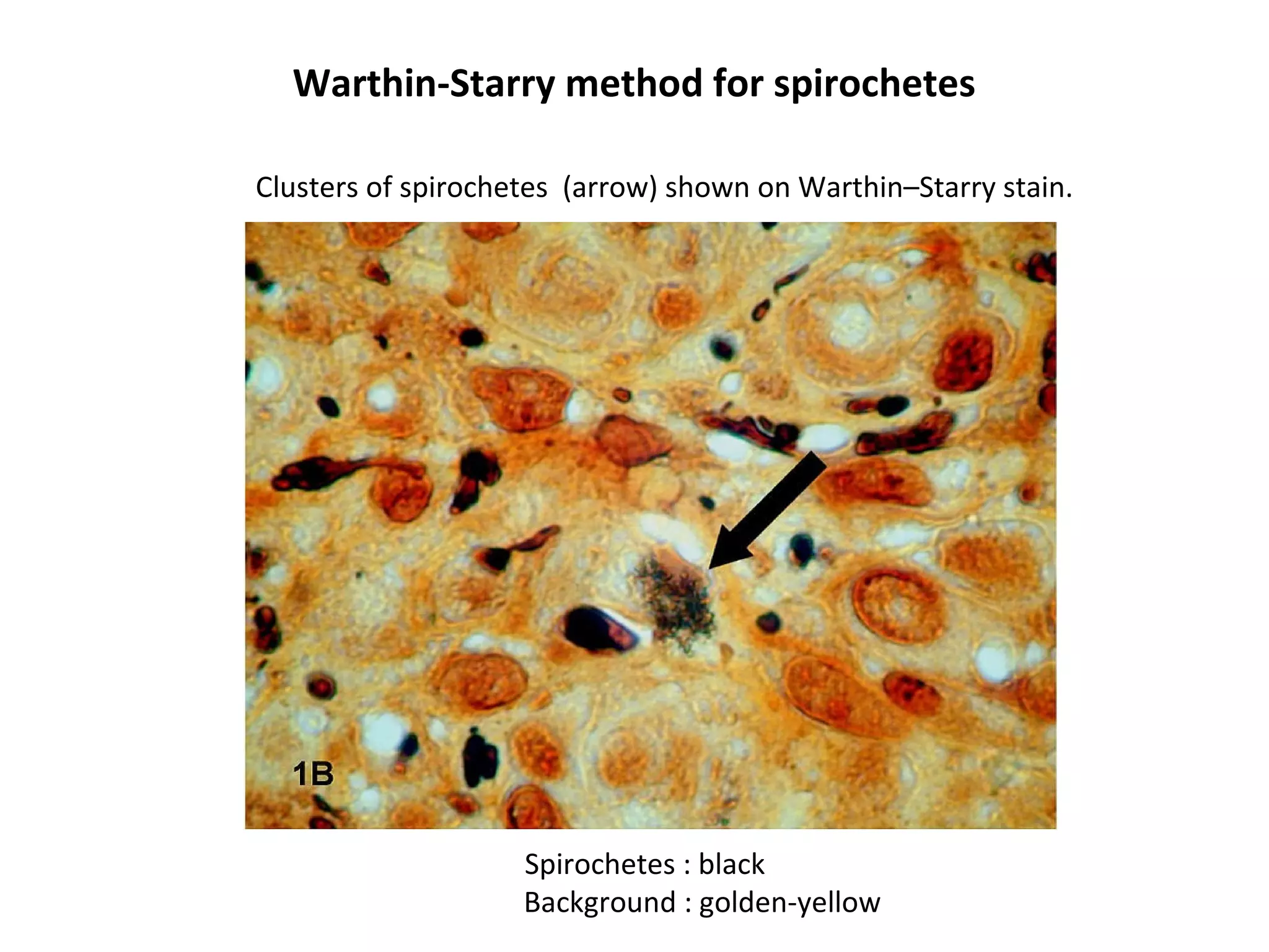 Silver Staining | PPT