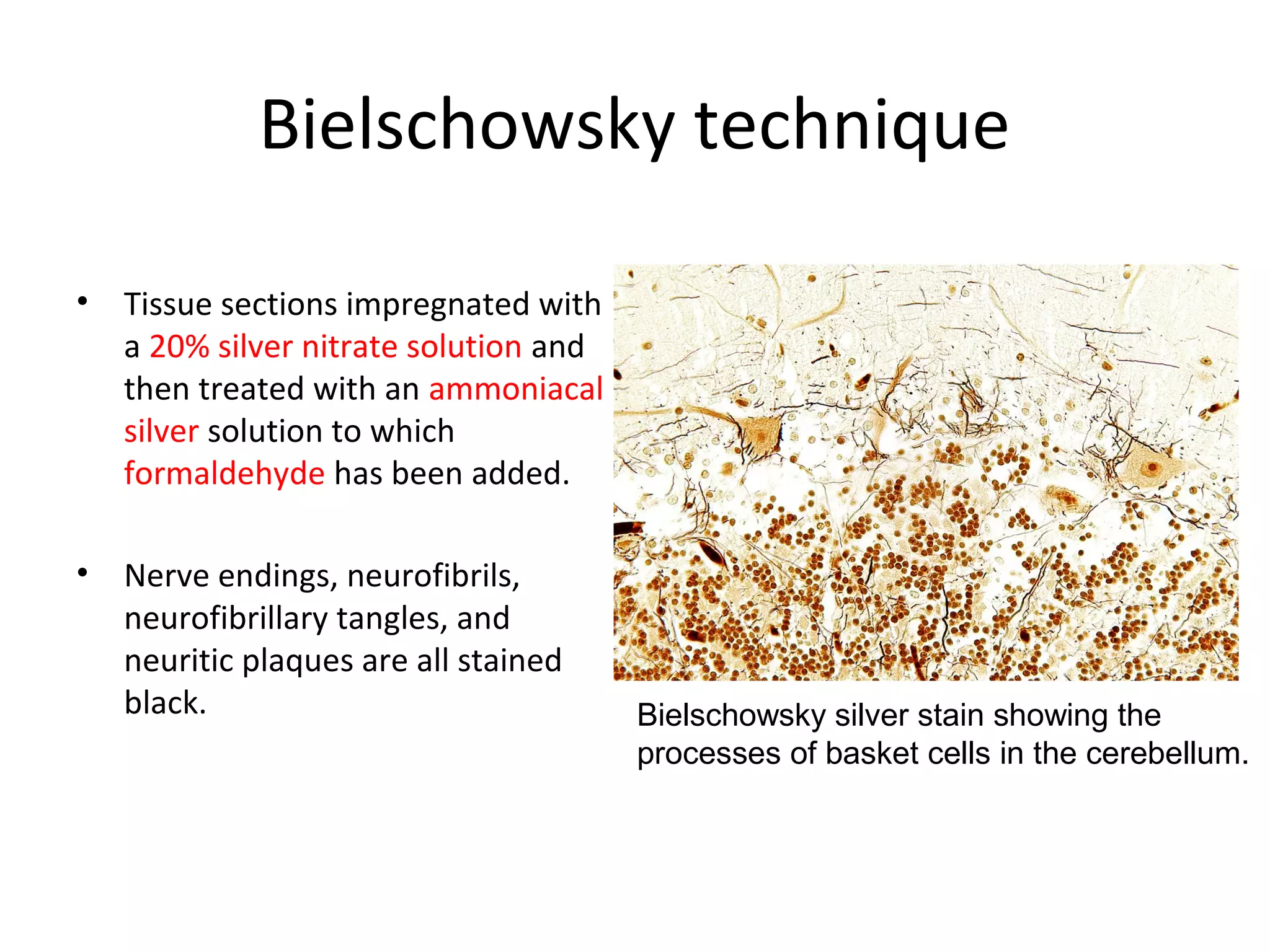 Silver Staining | PPT