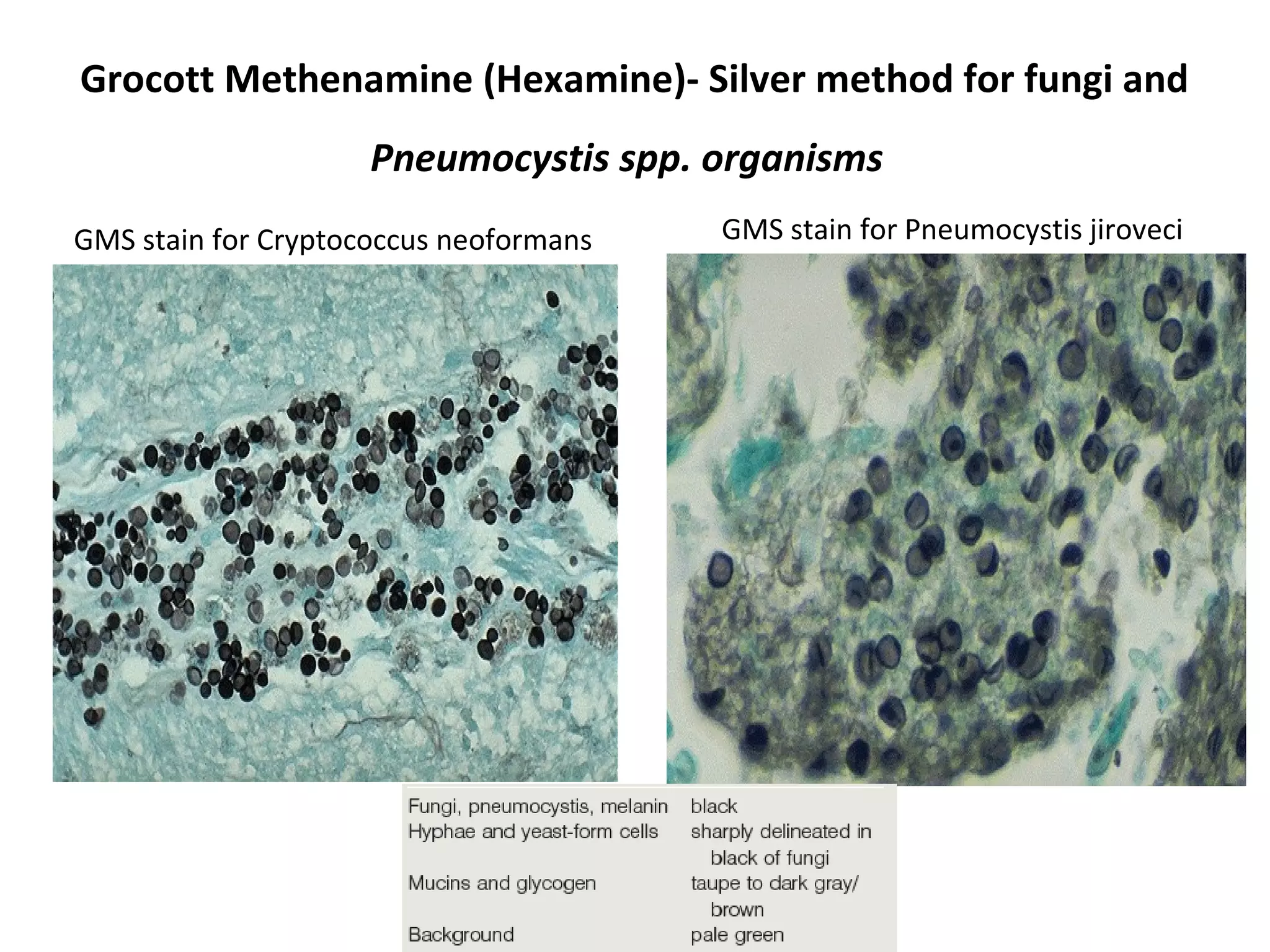 Silver Staining | PPT
